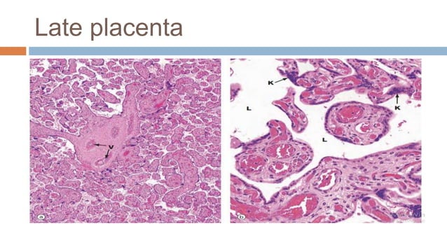 Histology of the Placenta.pptx | Pregnancy | Reproductive Health