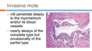 Histology of the Placenta.pptx