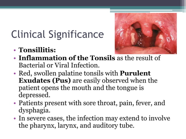 Histology of Tonsil | PPTX | Ear, Nose and Throat Conditions | Diseases and Conditions