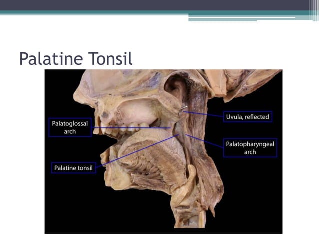 Histology of Tonsil | PPTX | Ear, Nose and Throat Conditions | Diseases ...