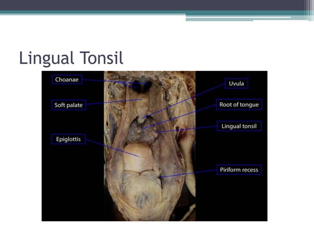 Histology of Tonsil | PPTX | Ear, Nose and Throat Conditions | Diseases ...