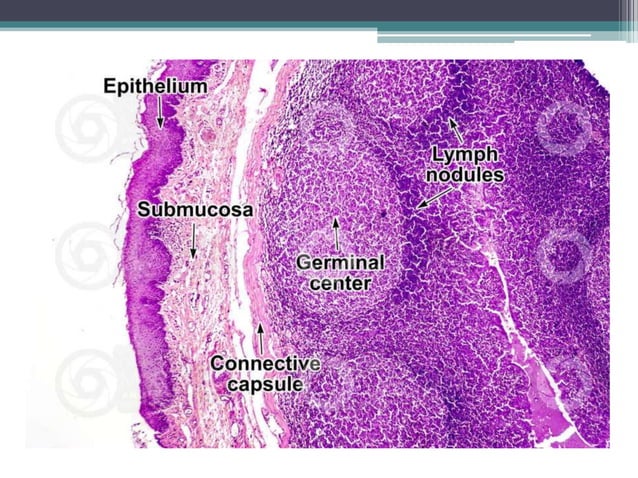 Histology of Tonsil