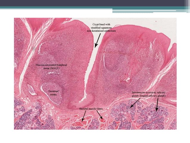 Histology of Tonsil