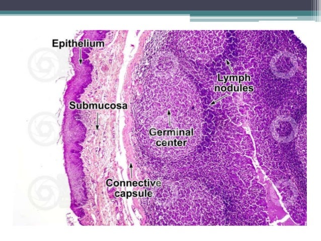 Histology of Tonsil