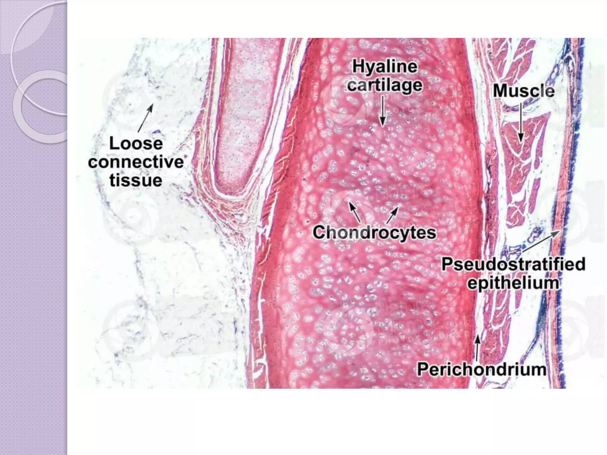 Histology of Trachea | PPTX