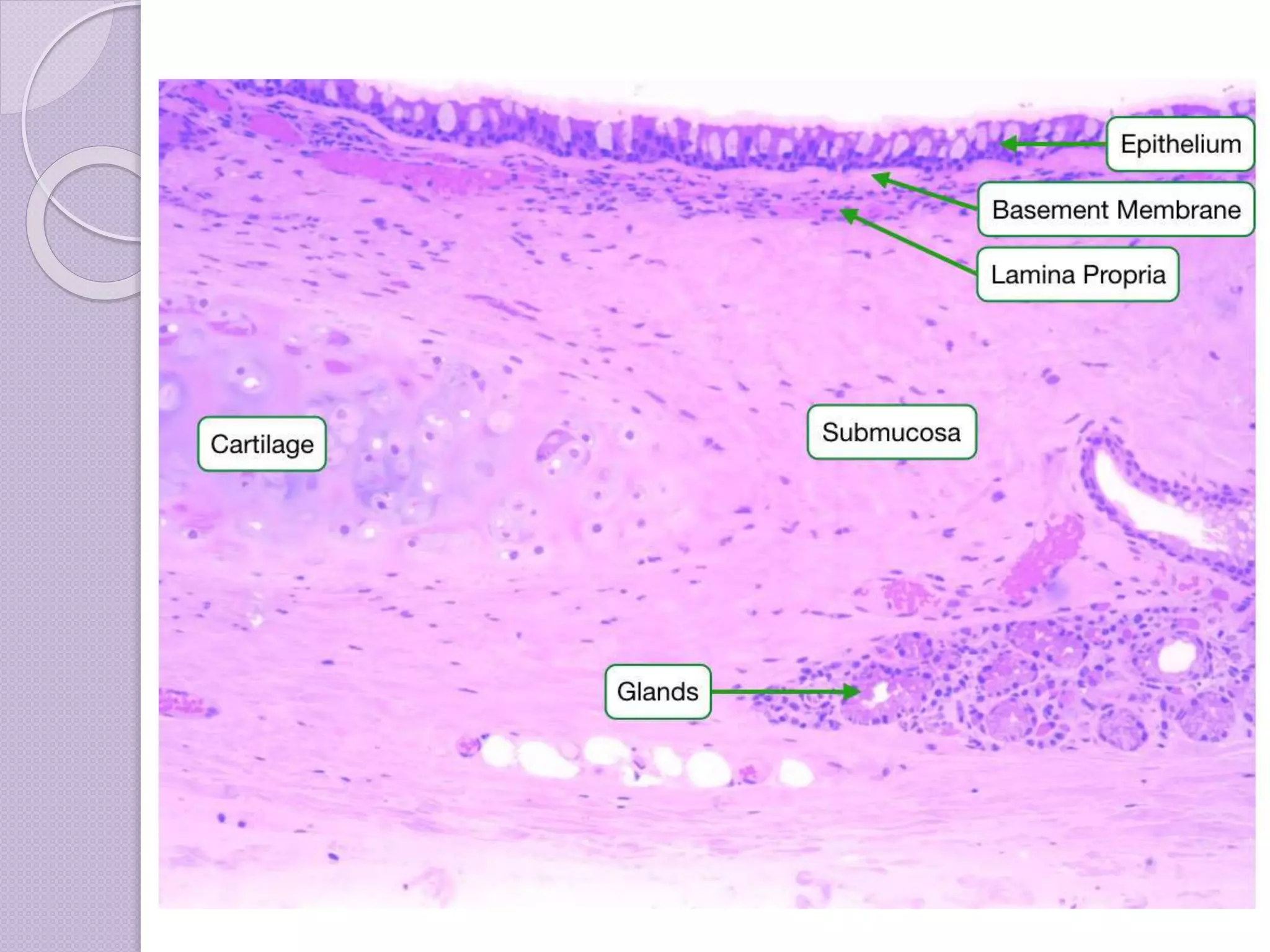 Histology of Trachea | PPTX