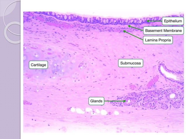 Histology of Trachea
