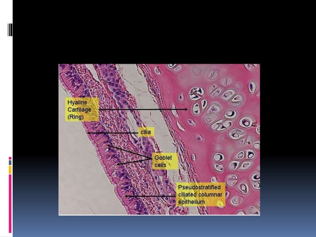 Histology of trachea and lung