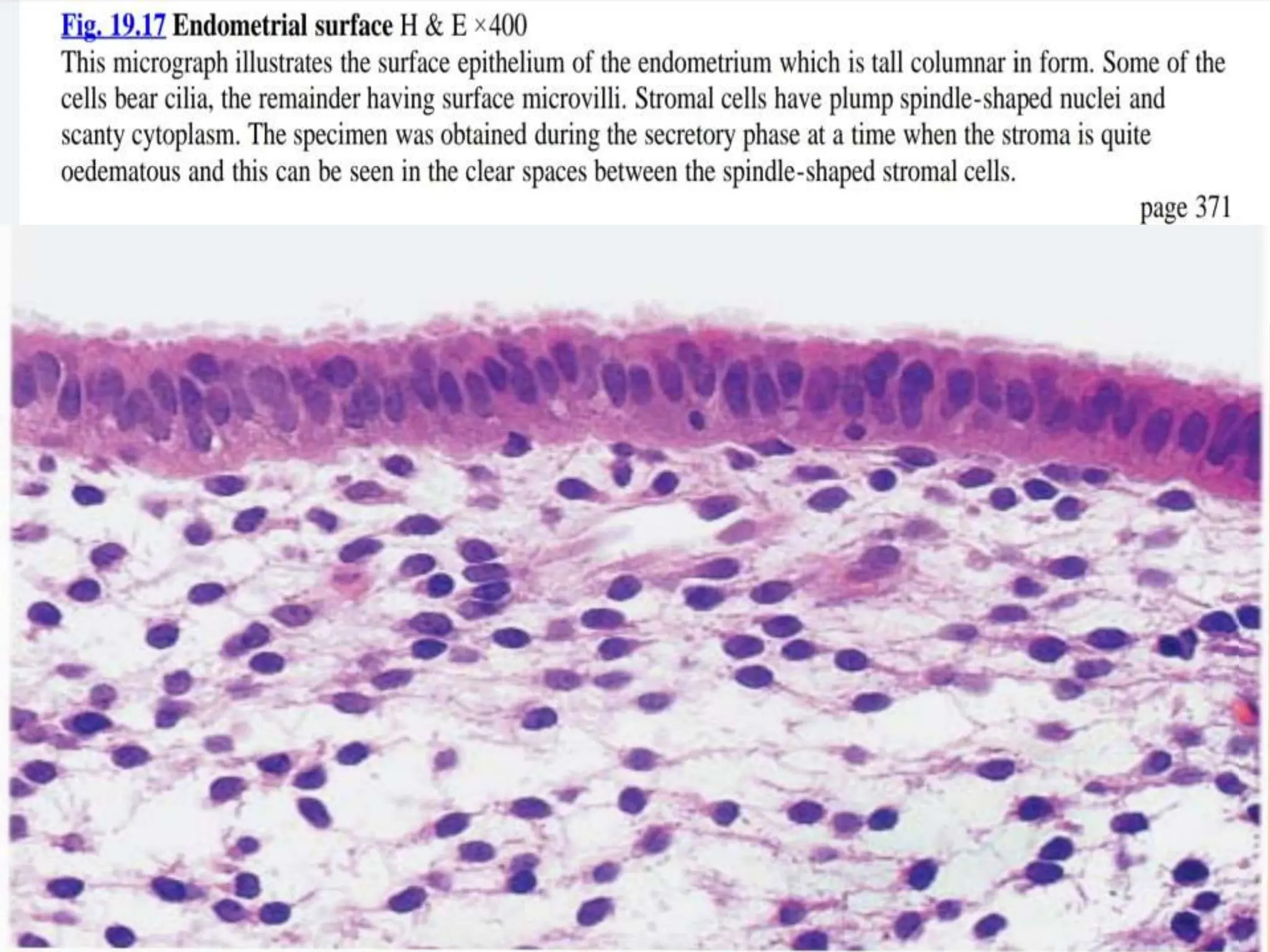 Histology of uterine endometrium.pptxXXX | PPTX