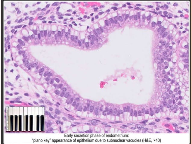Histology of uterine endometrium.pptxXXX | PPTX | Menopause | Endocrine ...