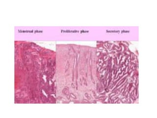 Uterus Slide Labeled