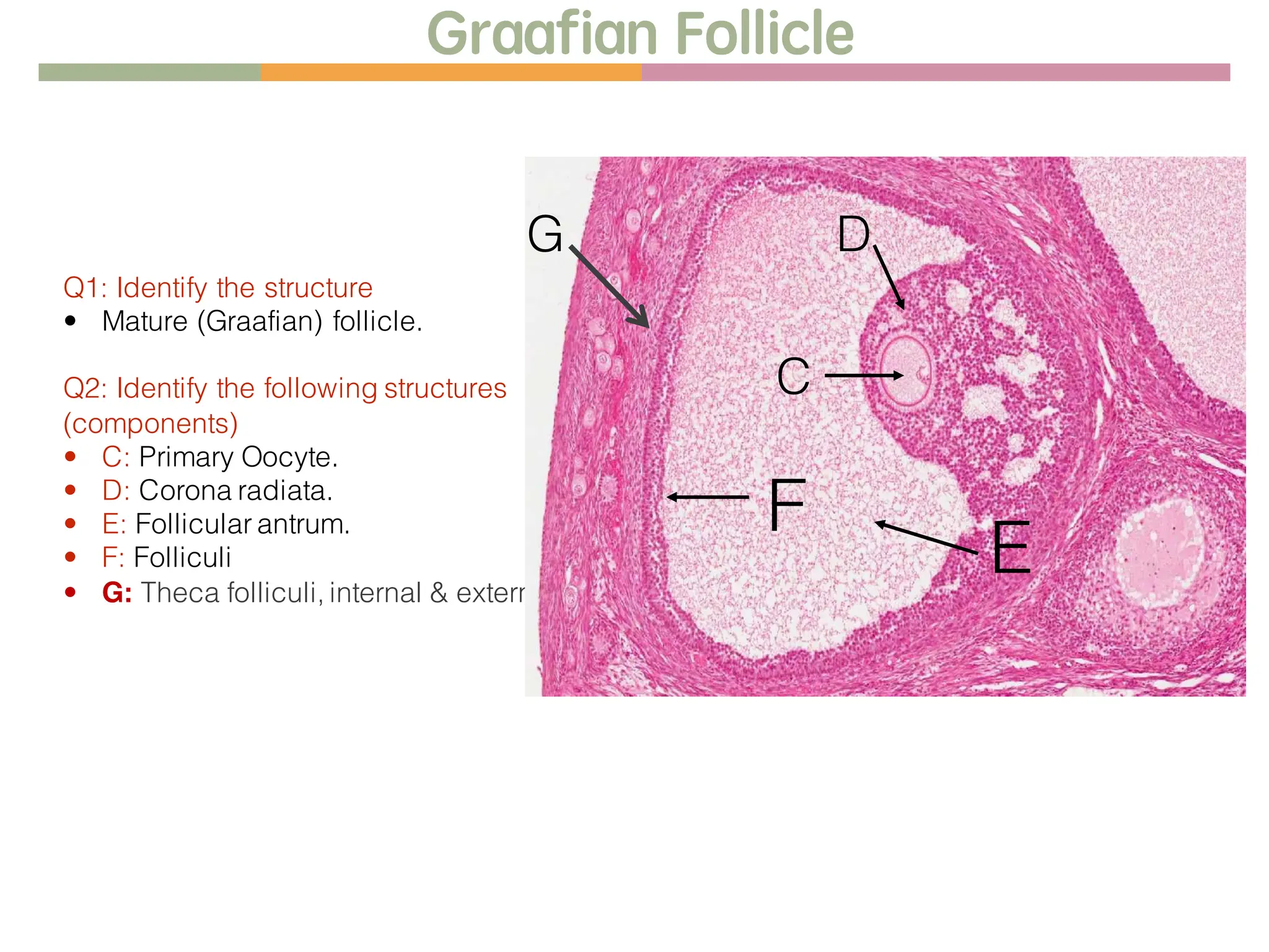 Histology OSPE about Female reproductive system | PDF