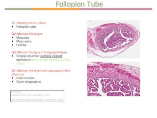 Histology OSPE about Female reproductive system | PDF