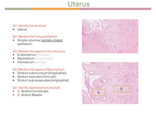 Histology OSPE about Female reproductive system | PDF