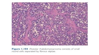 Histology pattern.pptx..pattern analysis | PPTX
