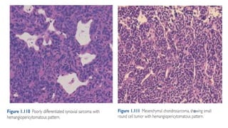 Histology pattern.pptx..pattern analysis | PPTX