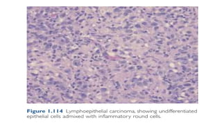 Histology pattern.pptx..pattern analysis | PPTX