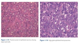 Histology pattern.pptx..pattern analysis | PPTX