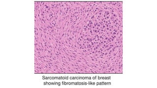 Histology pattern.pptx..pattern analysis | PPTX