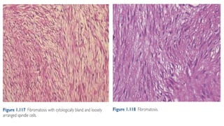 Histology pattern.pptx..pattern analysis | PPTX