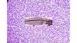 Histology pattern.pptx..pattern analysis | PPTX