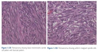 Histology pattern.pptx..pattern analysis | PPTX