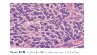 Histology pattern.pptx..pattern analysis | PPTX