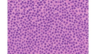 Histology pattern.pptx..pattern analysis | PPTX