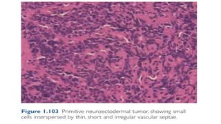 Histology pattern.pptx..pattern analysis | PPTX