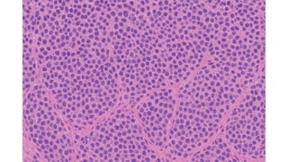 Histology pattern.pptx..pattern analysis | PPTX