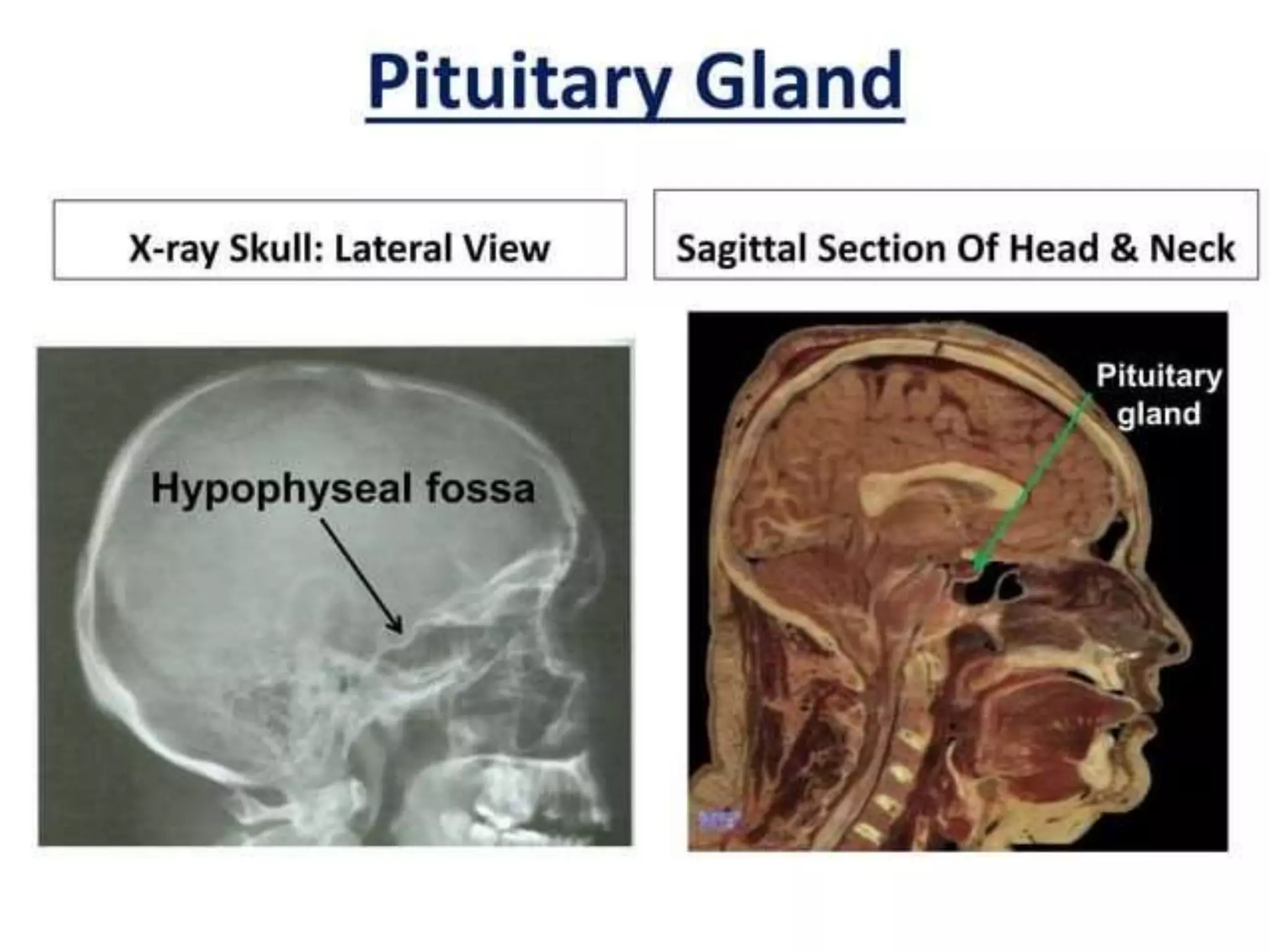 histology pitutary gland.pptx