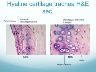 Hyaline Cartilage Trachea 400x
