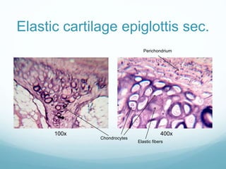 Elastic Cartilage Slide 400x