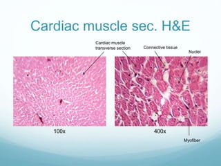 Smooth Muscle Slide 400x