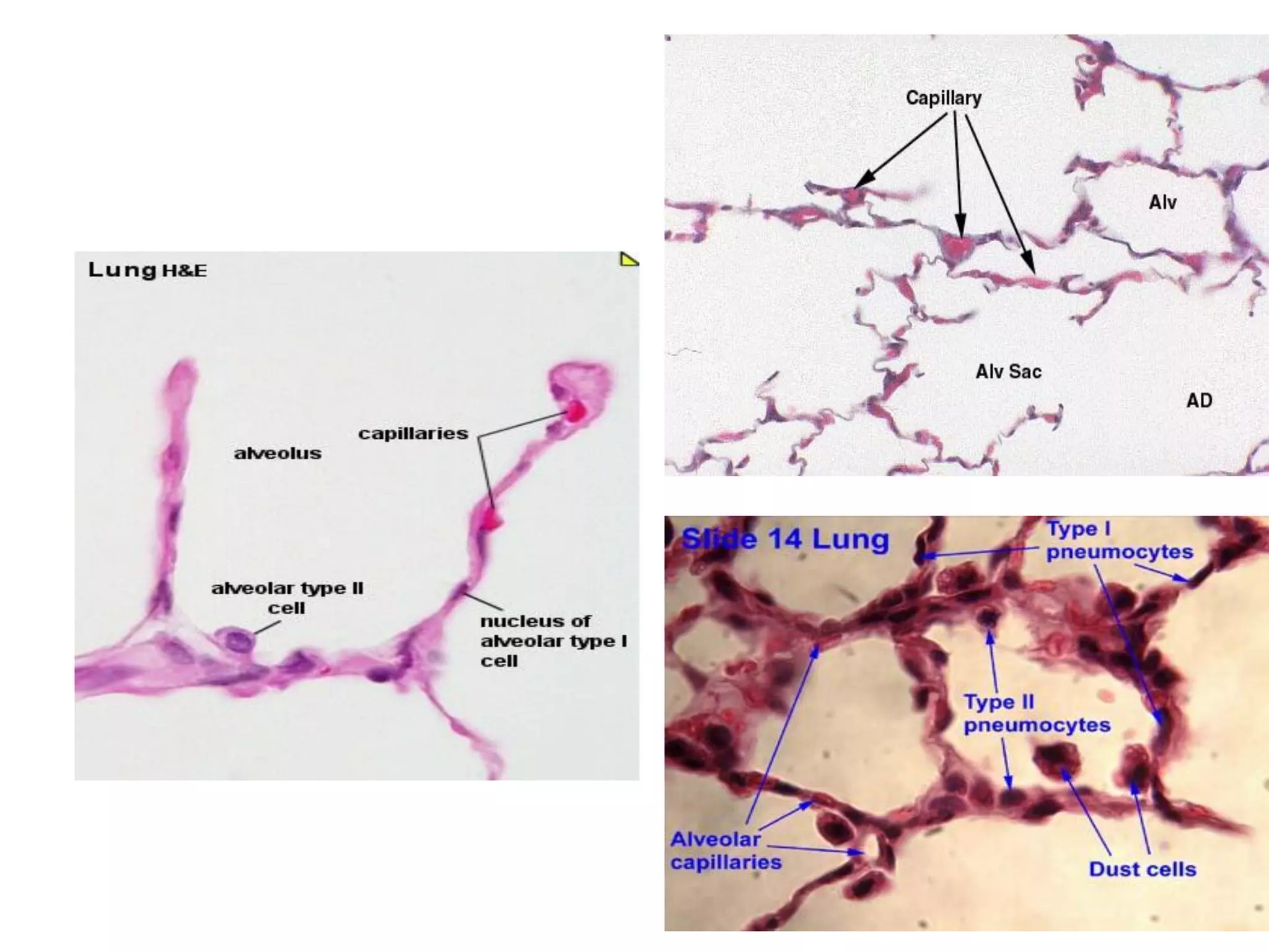 Alveoli Histology Labeled