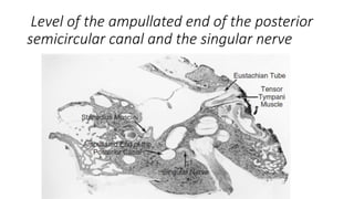 Histology slides for case presentation for Nasopharyngeal Angiofibroma ...