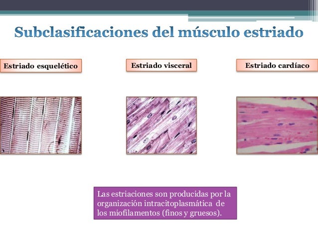 Histo, musculo estriado