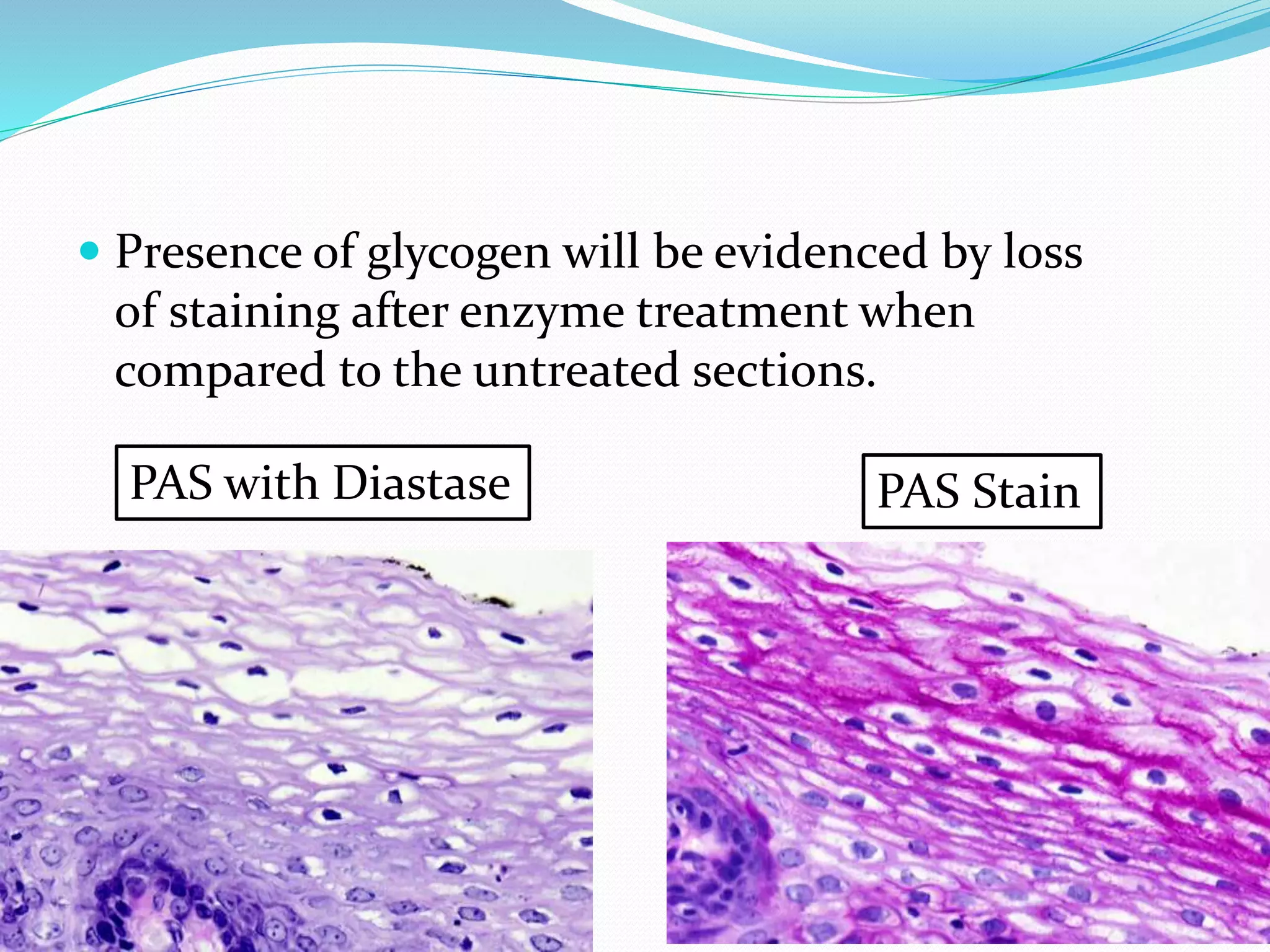 Histopatholgy staining by suchit kumar | PPTX