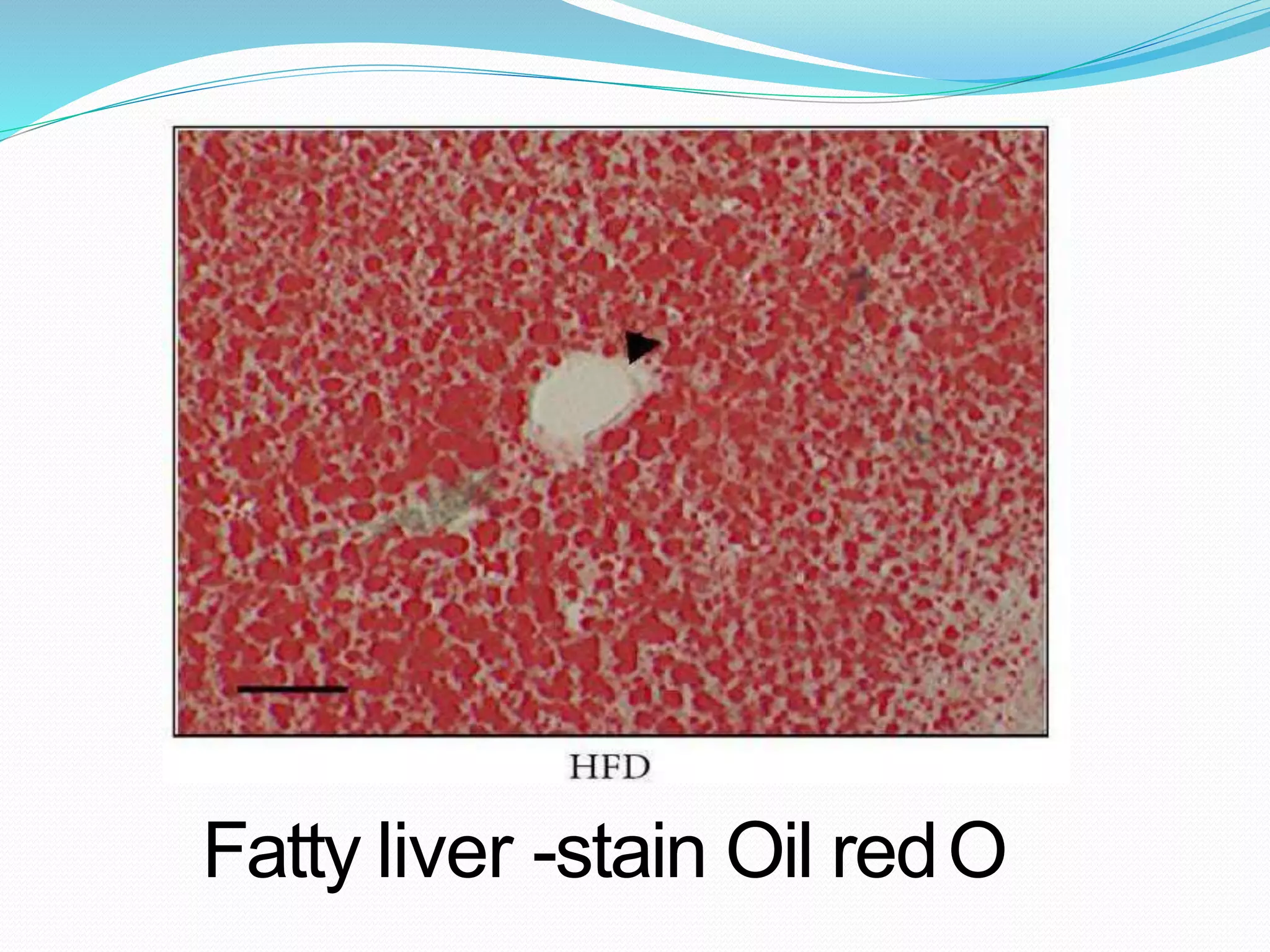 Histopatholgy Staining By Suchit Kumar Ppt