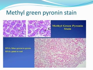 Histopatholgy staining by suchit kumar | PPTX