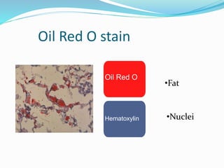 Histopatholgy staining by suchit kumar | PPTX