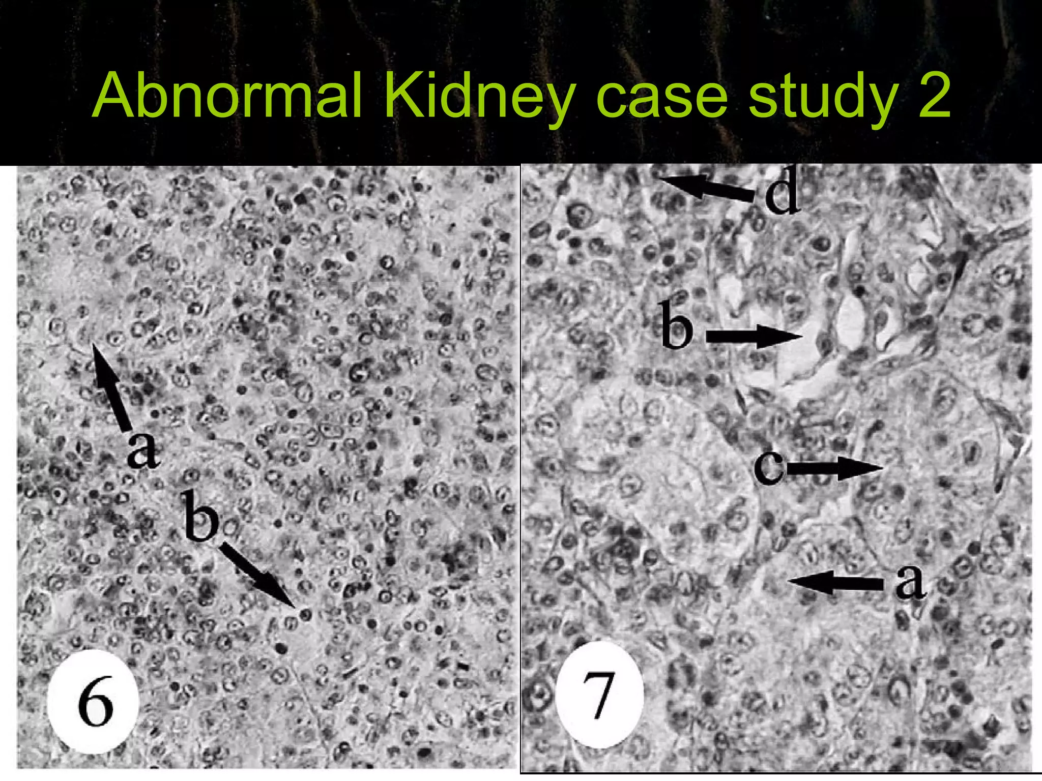 Histopathological Kidney Honours Powerpoint | PPT