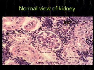 Histopathological Kidney Honours Powerpoint | PPT