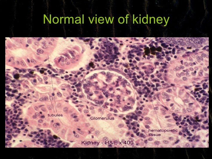 Histopathological Kidney Honours Powerpoint