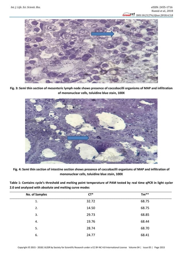 Histopathological And Rt Pcr Detection Of Mycobacterium