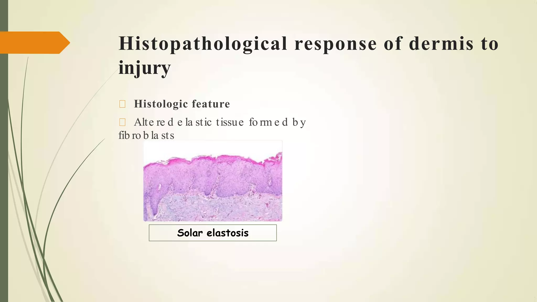 Histopathological response of the skin | PPTX