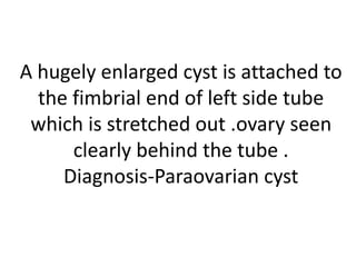 HISTOPATHOLOGICAL SPECIMEN OF OBSTETRICS AND GYNAECOLOGY.pptx