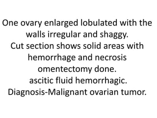 HISTOPATHOLOGICAL SPECIMEN OF OBSTETRICS AND GYNAECOLOGY.pptx