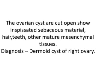 HISTOPATHOLOGICAL SPECIMEN OF OBSTETRICS AND GYNAECOLOGY.pptx