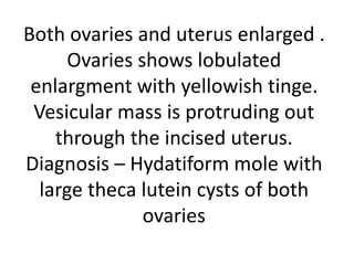 HISTOPATHOLOGICAL SPECIMEN OF OBSTETRICS AND GYNAECOLOGY.pptx